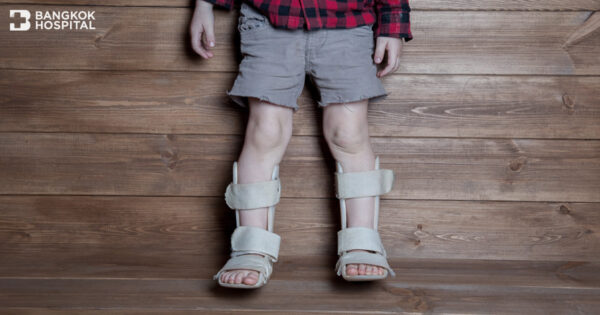 Pediatric Foot Deformities | Bangkok International Hospital (Brain x Bone)