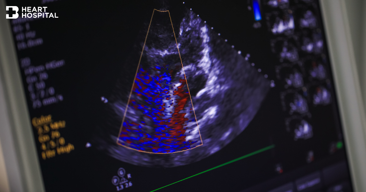 Echocardiogram | Bangkok Heart Hospital