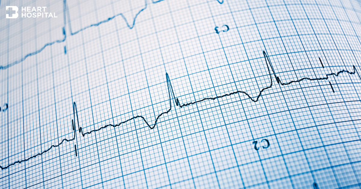 ECG သို့မဟုတ် EKG | Bangkok Heart Hospital