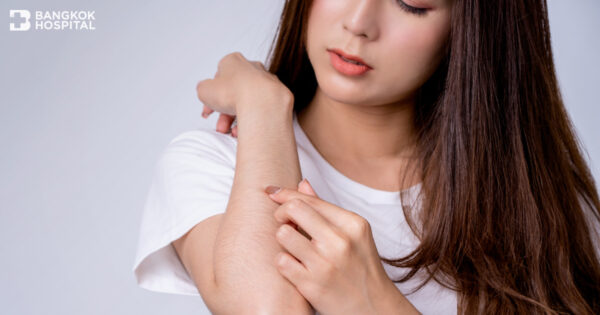 MORPHEA: A Skin Condition That Can Be Detrimental To Your Self ...