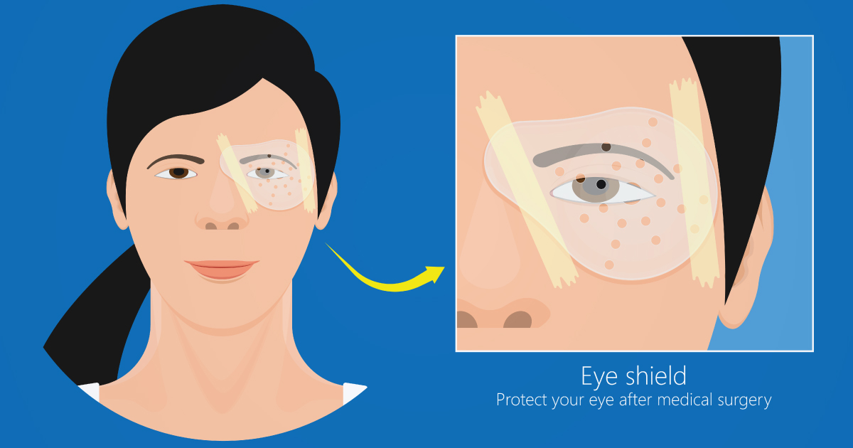 ReLEx SMILE สบายตากับเลสิกไร้ใบมีด | โรงพยาบาลกรุงเทพ สำนักงานใหญ่
