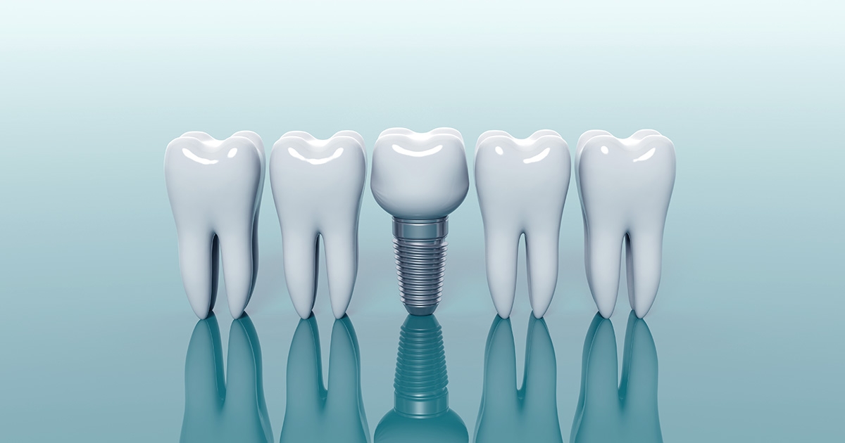 ทันตกรรมรากเทียม (Dental Implant) | โรงพยาบาลกรุงเทพขอนแก่น