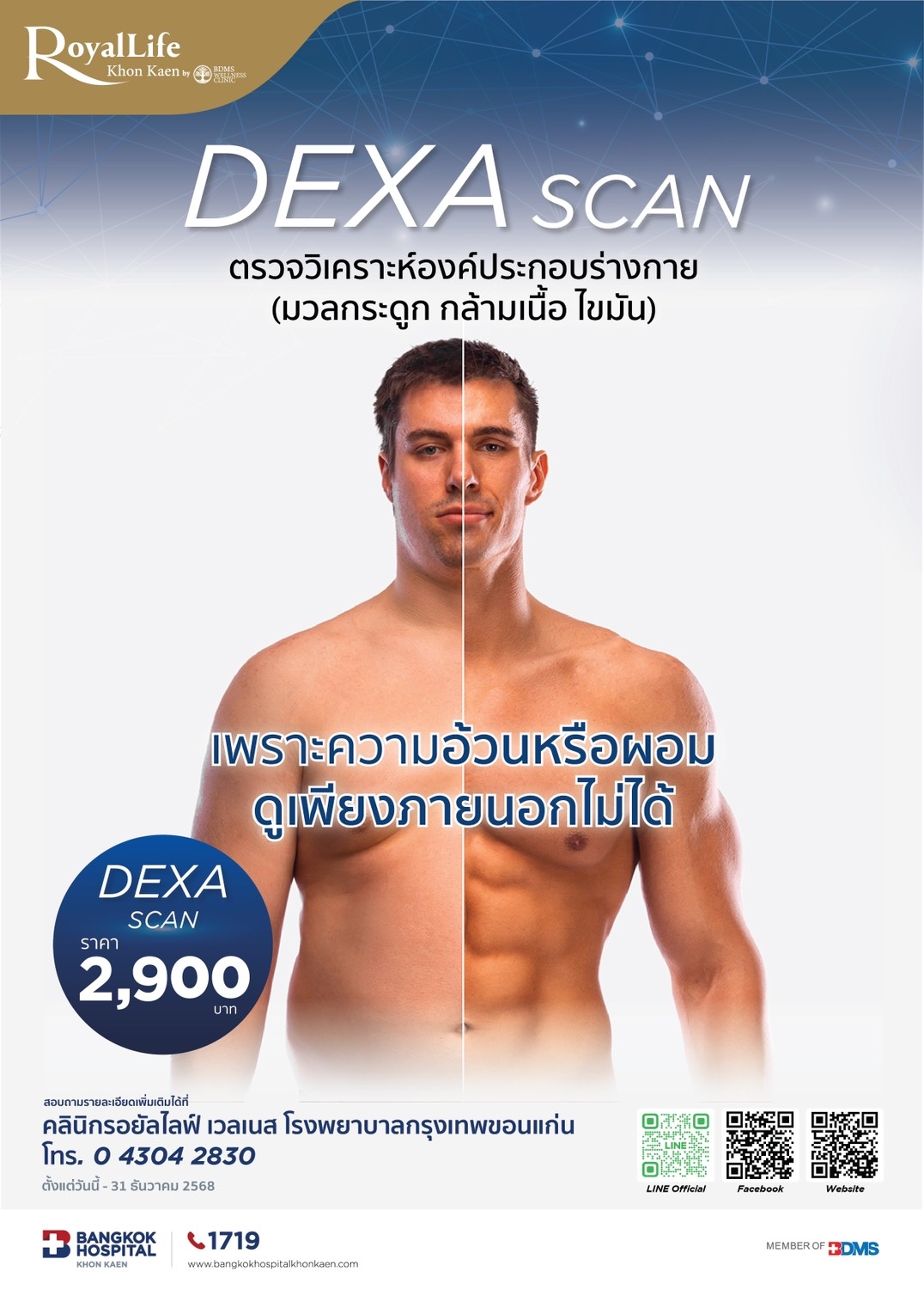 DEXA SCAN | โรงพยาบาลกรุงเทพขอนแก่น