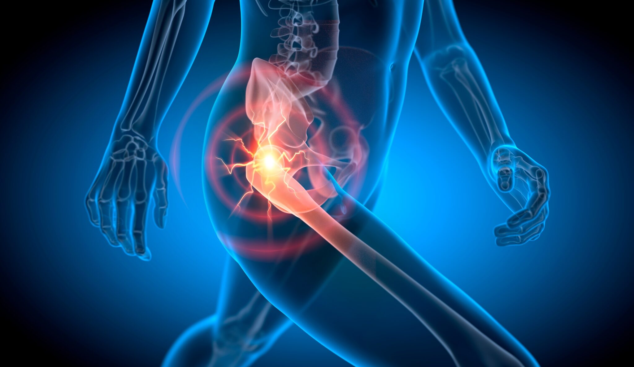Falls in Seniors: A Broken Hip Can Change a Life | Bangkok Hospital Hua Hin